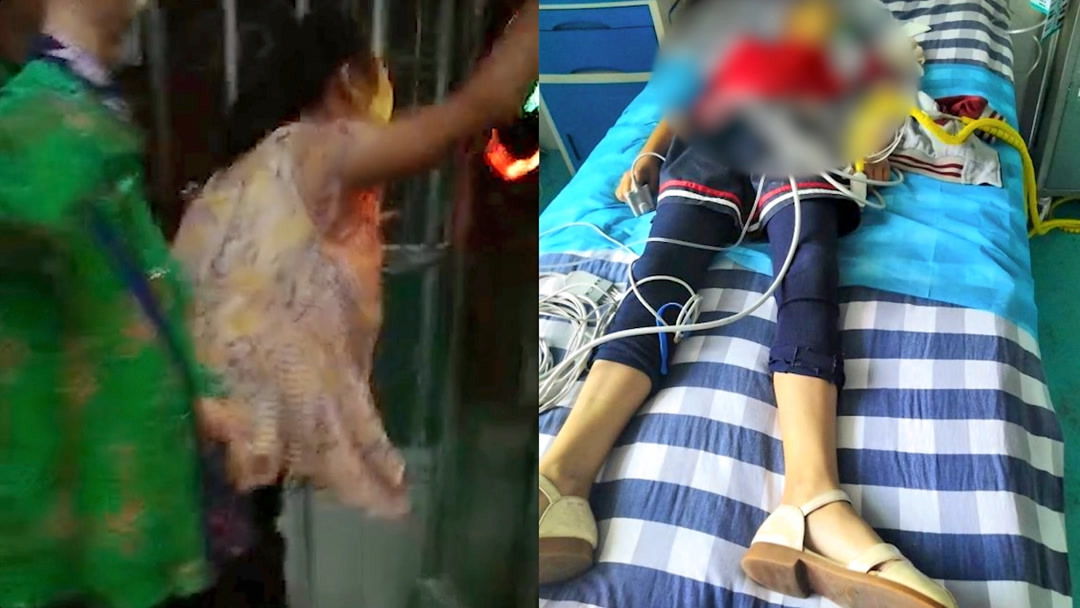 四川一小学生疑似被老师体罚后身亡 警方已介入调查