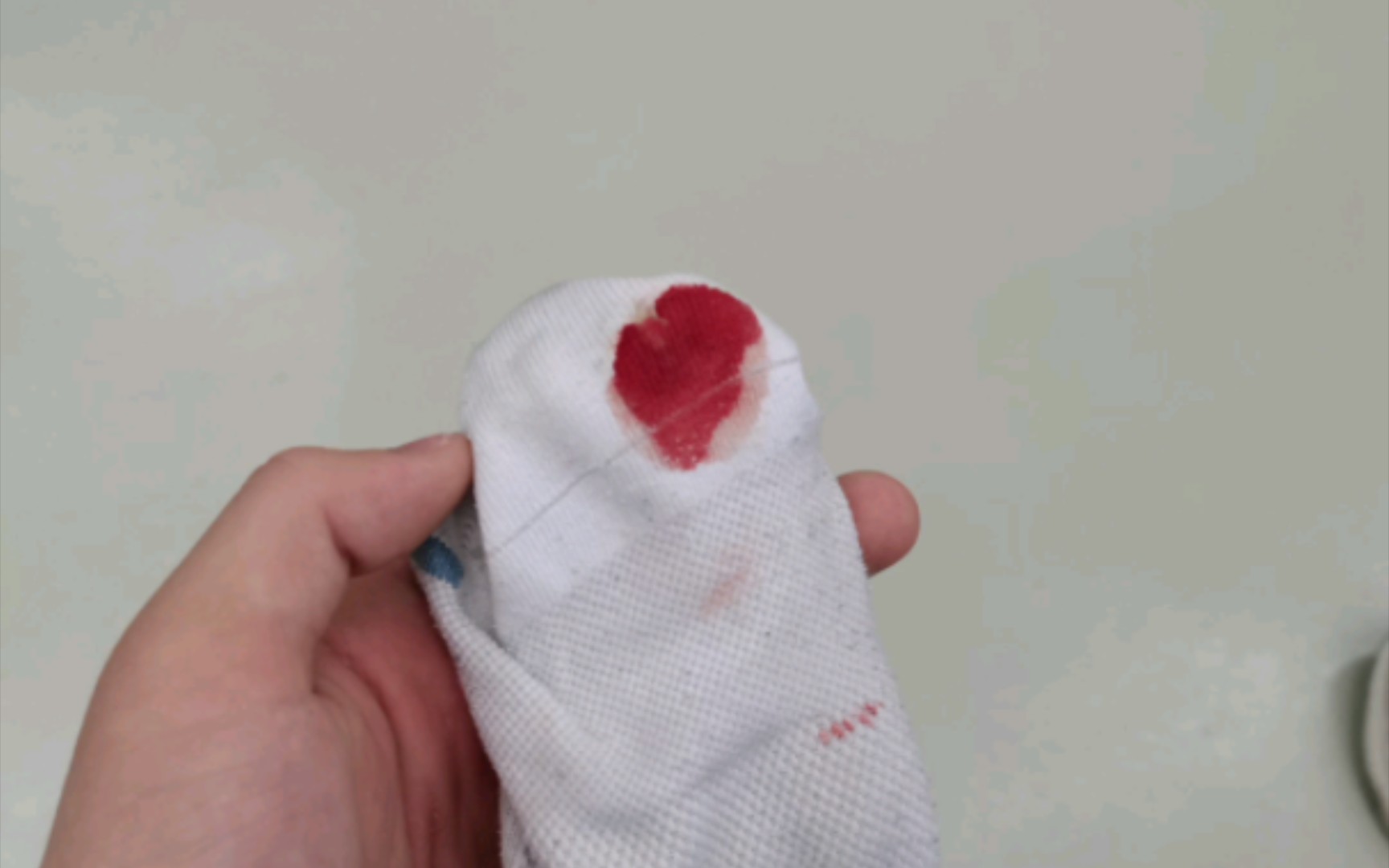 甲沟炎被踩一下是什么体验