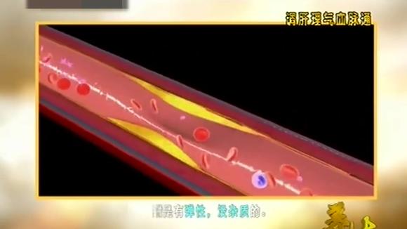 什么是动脉硬化?跟血管有直接关系,看完专家讲解真是长知识了