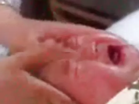 《岳氏中医学堂》之小儿推拿治疗小儿常见多发病的推拿治疗_咳嗽