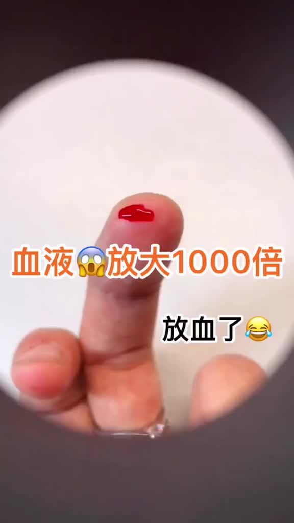 显微镜下的血液发现了好多带刺的这是什么有没有大神知道