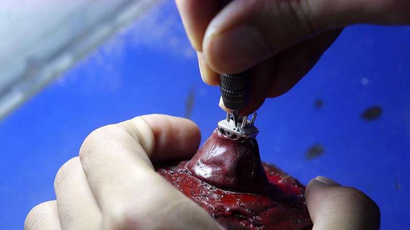 粉丝改款钻石戒指,和小黄沟通后,定了这个方案