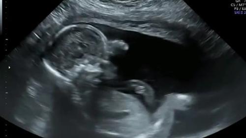 怀孕24周女宝宝胎动视频,宝宝在母体内动作优雅,妈妈好快乐!