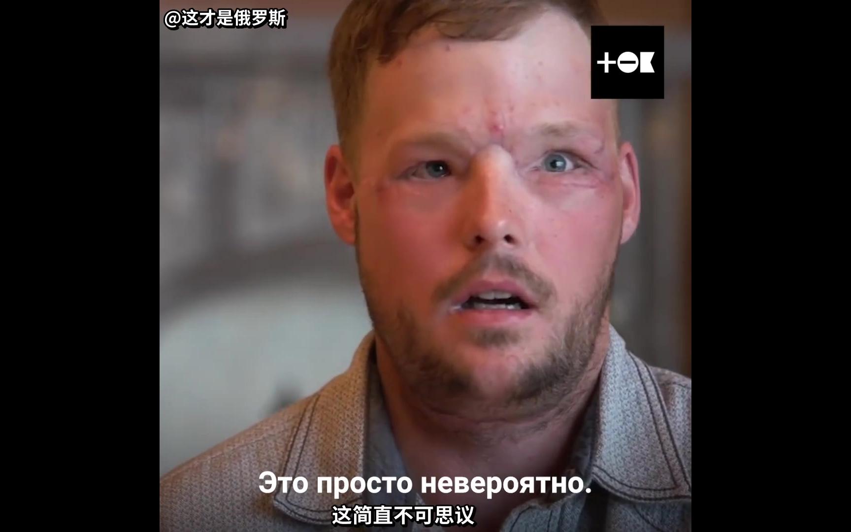 当看到去世丈夫的脸被移植到一个陌生人的脸上是怎么样的一种感受?