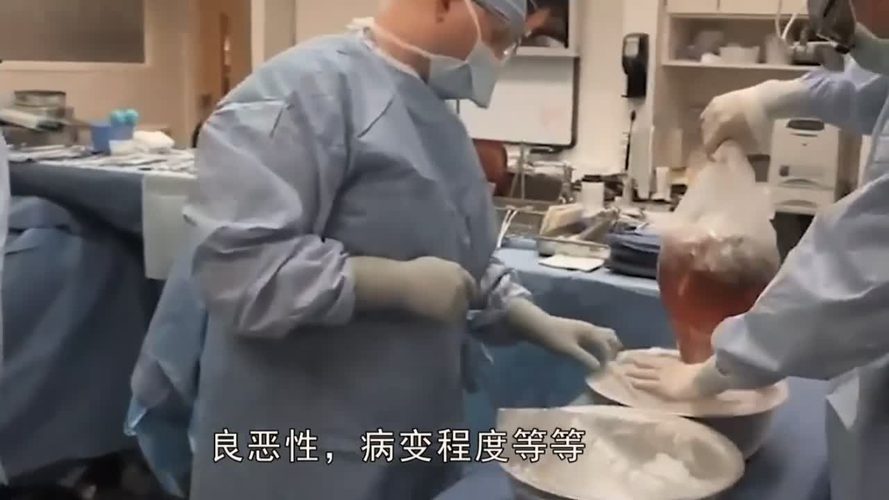 医院做手术,切下来的器官都是怎么处理的?医生说出了真相!