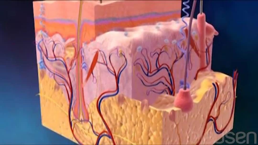 医学3D动画演示:皮肤癌的发生及分类
