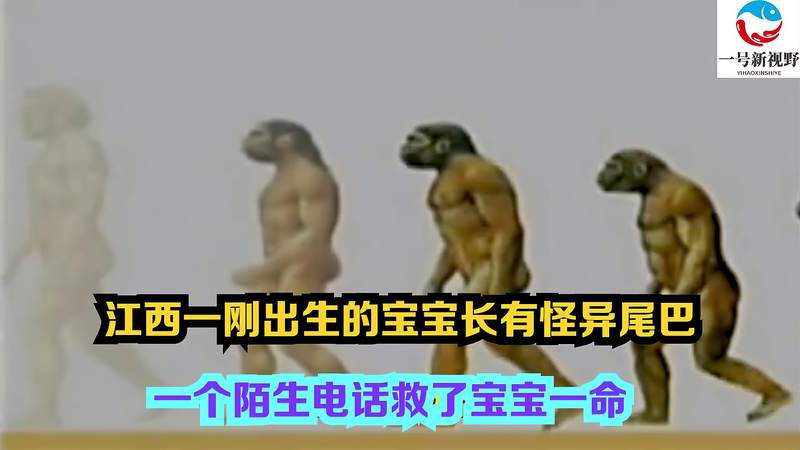 江西一刚出生的宝宝长有怪异尾巴,一个陌生电话救了宝宝一命
