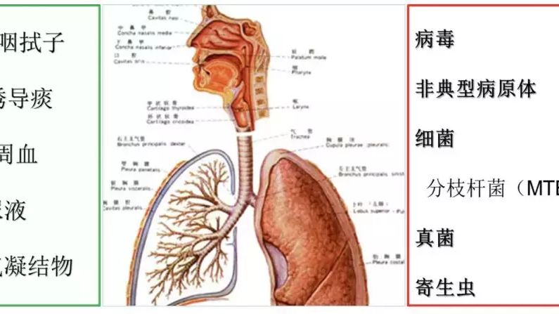 侯刚:诊断性支气管镜技术在肺部感染中的应用 | CACP 2019