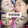 爱丽阁美容店皮肤修复 