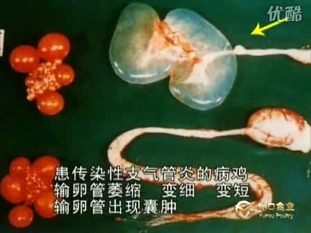 传染性支气管炎