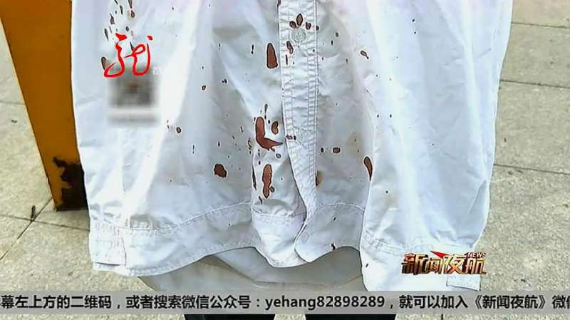 乘出租车起纠纷 两男子打伤司机