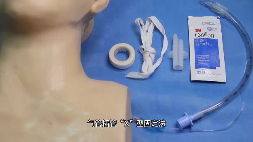 #护理 气管插管X型固定,视频只是交流不是科普