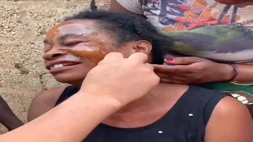 非洲美女去死皮,没想到脸上的毛太多,这下尴尬了!