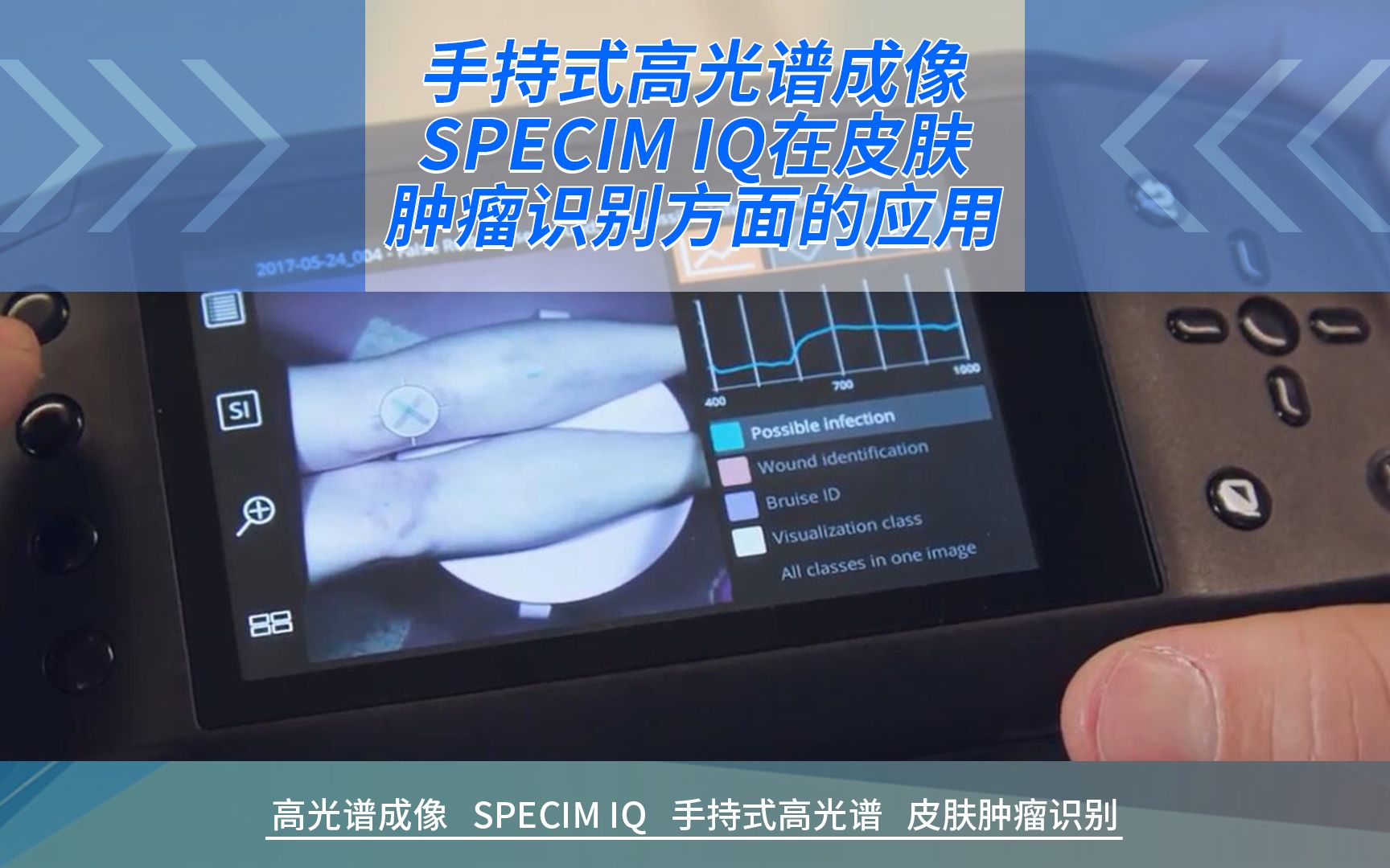 中文字幕|手持式高光谱成像SPECIM IQ在皮肤肿瘤识别方面的应用