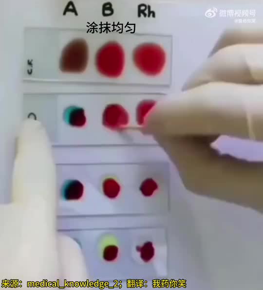 我们的血型都是怎么测定的?(来源:微博@我药你笑)