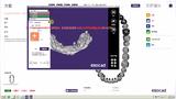 牙科CAD软件ExoCad DentalDB CAM&CAD 2015-2011版本均可使用...