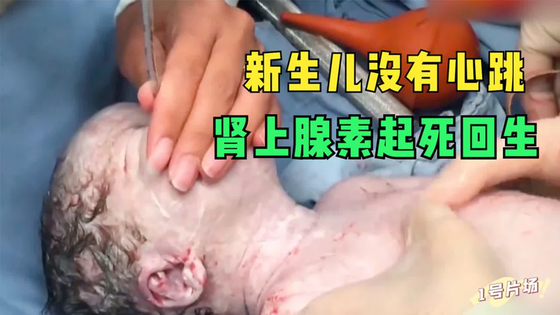 真实记录新生儿抢救全过程,5针肾上腺素下去,奇迹出现!