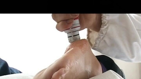 医疗冲击波治疗劳损病-