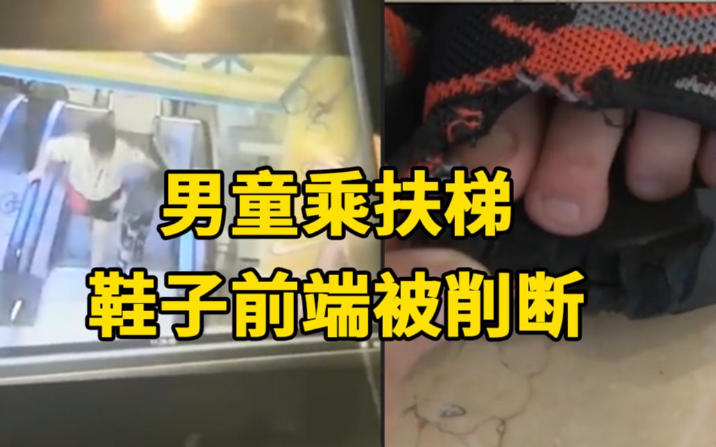 重庆6岁男童乘扶梯鞋尖被“咬掉”,孩子吓得说不出话