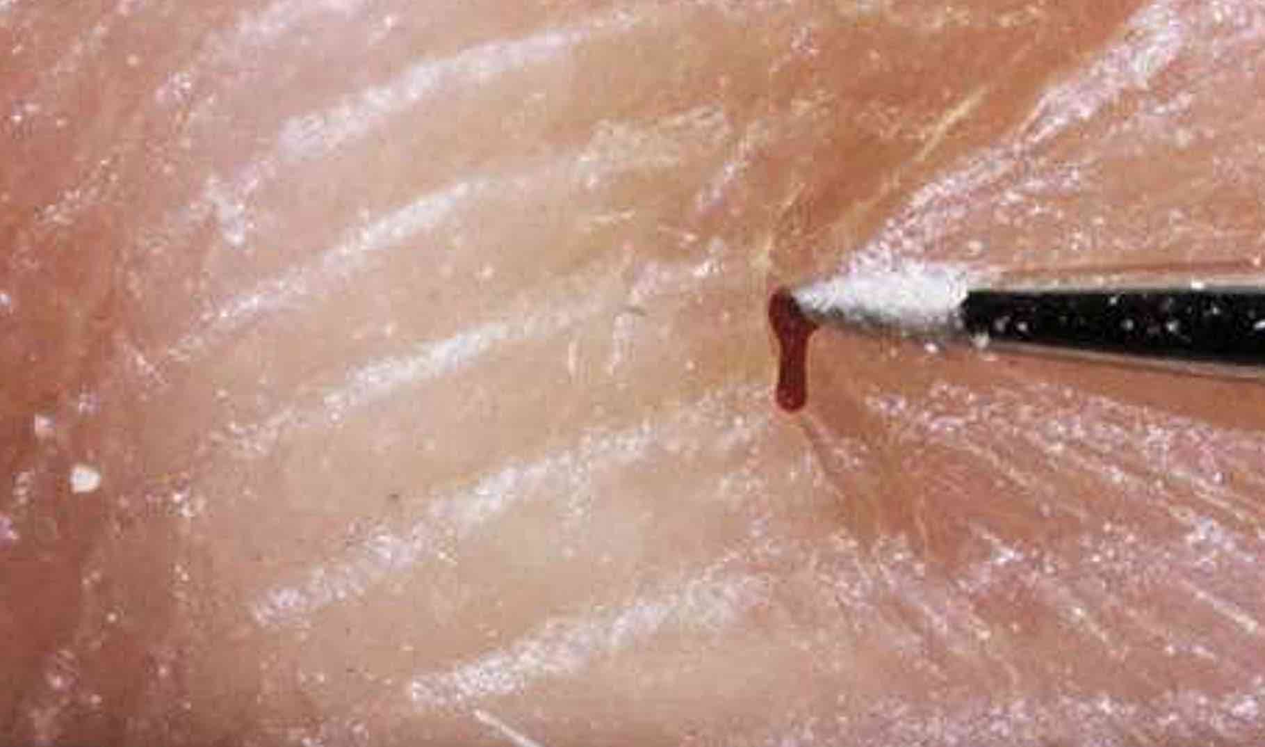 高倍显微镜下观察打针全过程,扎进去的瞬间,网友:头皮发麻!