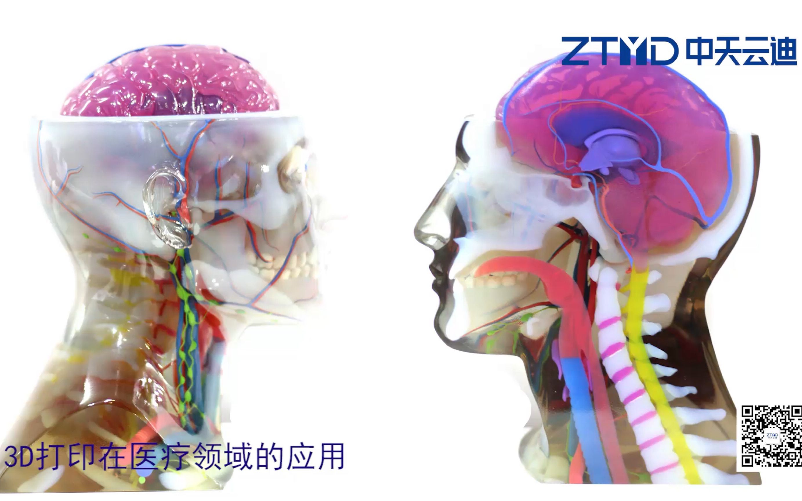 武汉中天云迪:3D打印在医疗领域的应用