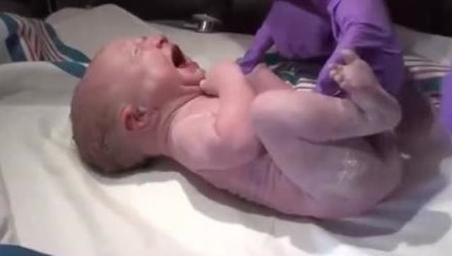 刚出生的婴儿那么脏,护士是怎么处理的?视频记录全过程