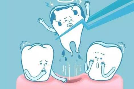 双排牙需要拔掉吗?还是不用管?