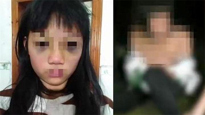 13岁少女遭殴打扒衣被围观,施暴者因未成年行政拘留不执行