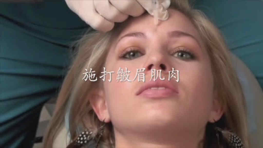 注射肉毒杆菌 去除皱眉纹、鱼尾纹、抬头纹全过程