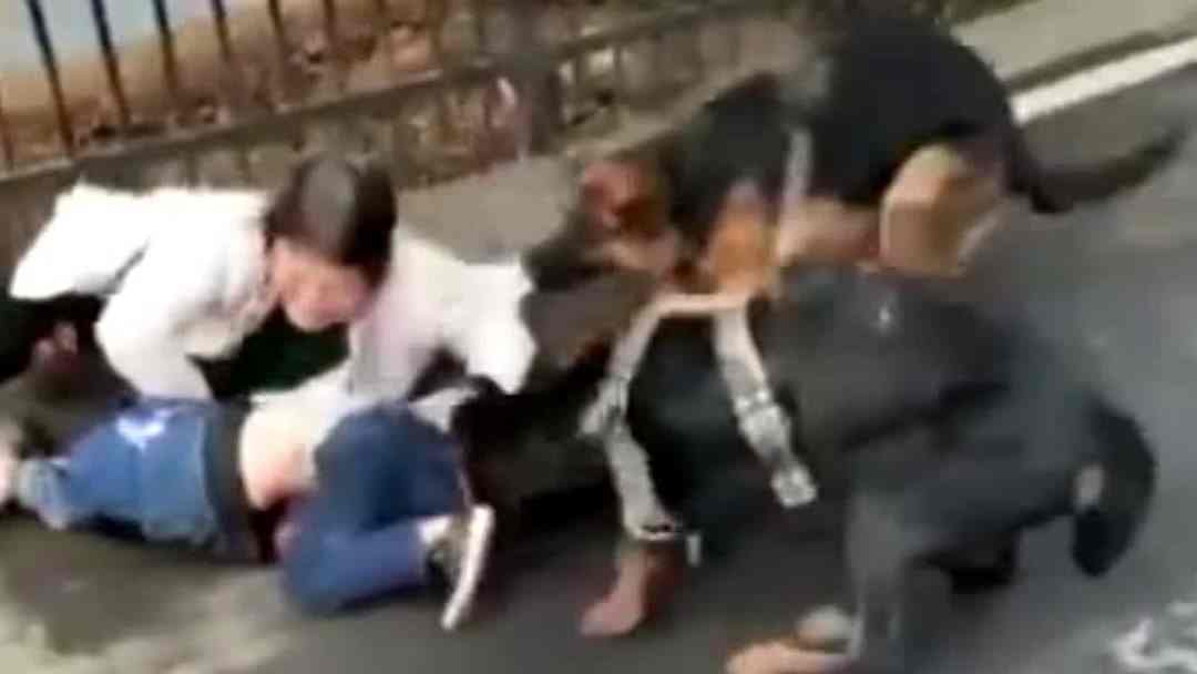 街头俩恶狗疯狂咬人 老人拼命护住被咬小孩