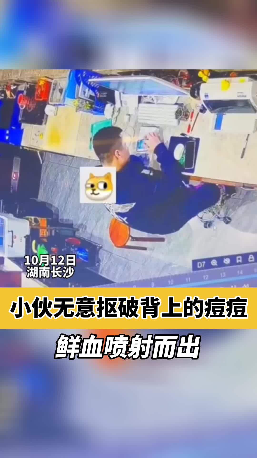 ...喷射而出。医生:抠到血管了。#痘痘 #长见识了 #危险瞬间请勿模仿