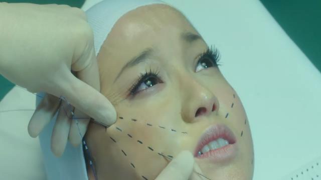 日本丑女全身整容后变大明星, 副作用让全身腐烂最后沦落夜店