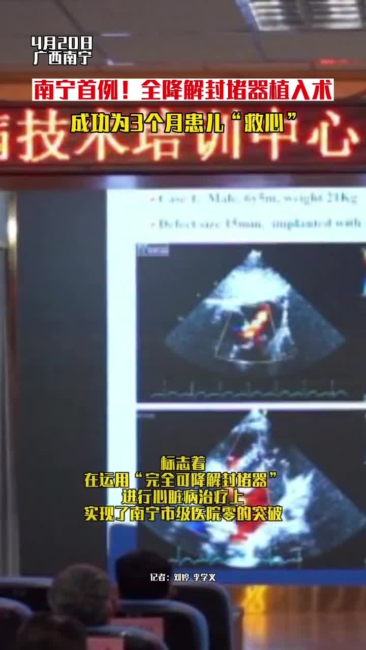 南宁完成首例全降解封堵器植入术,成功为一3个月患儿"救心"。