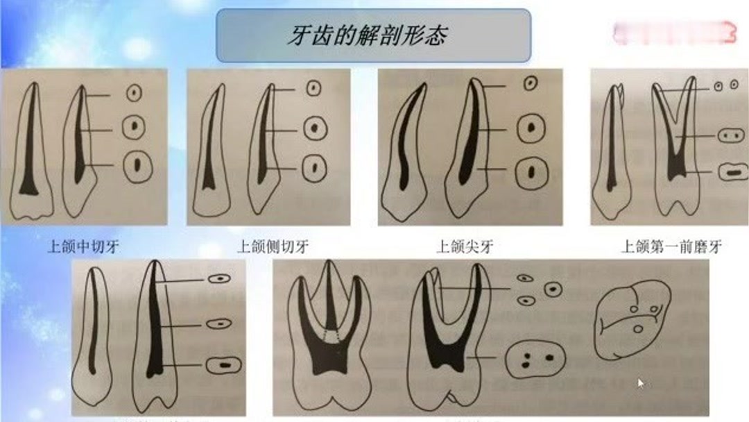 根管治疗第一节上