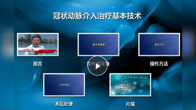 冠脉介入 左右冠支架置入 经桡动脉冠脉 分叉 造影 培训视频 基础