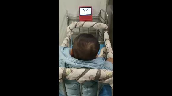 治疗完的血管瘤宝宝专心看动画片。