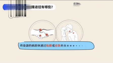 8.4《新型冠状病毒感染的肺炎知识》