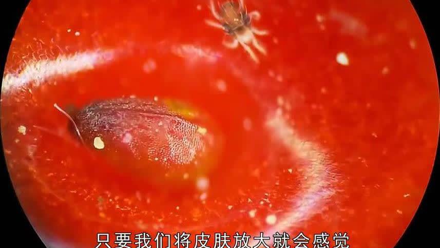 显微镜下的皮肤是什么样的,美女决定一探究竟,不料看完真惊讶