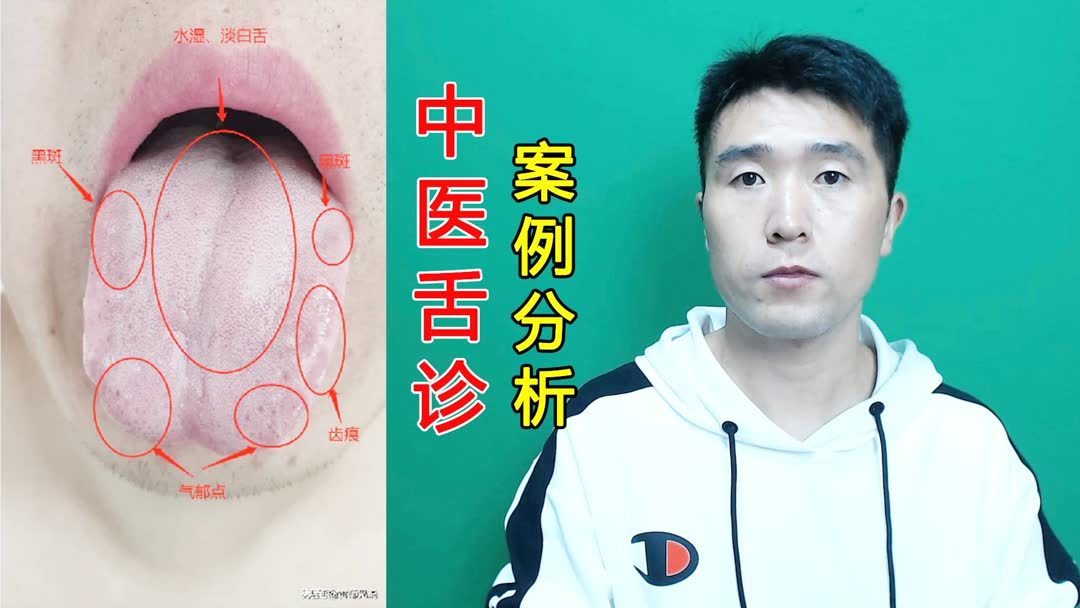 舌诊案例分析,中医教你如何辩证,气血不足、湿气重2套调理方案