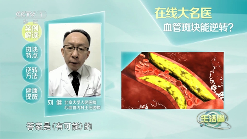 [生活圈]在线大名医:血管斑块能逆转?