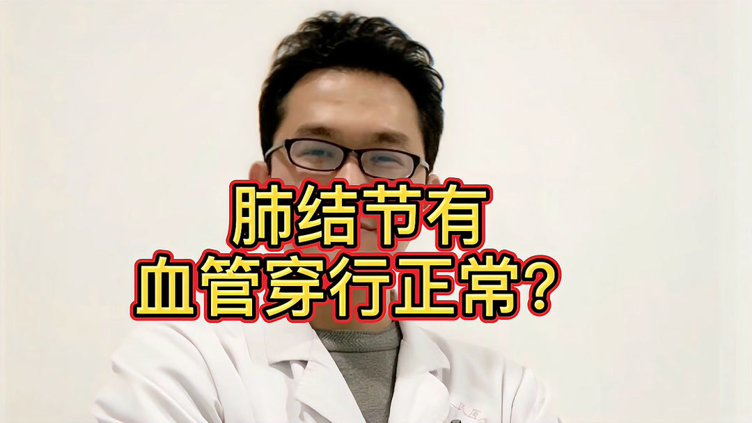 肺结节有血管贴近或穿行正常?听听宋医生怎么说