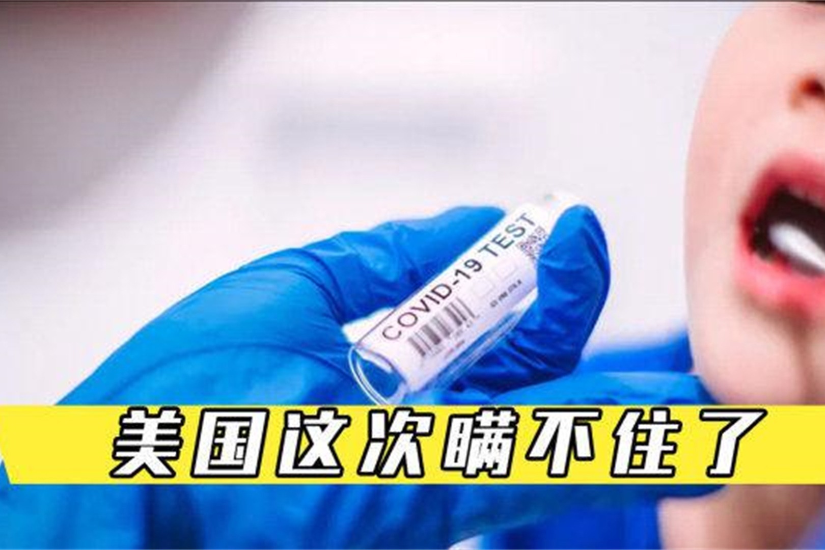 美国这下瞒不住了,故意隐瞒数月后,新冠病毒一重要线索被发现