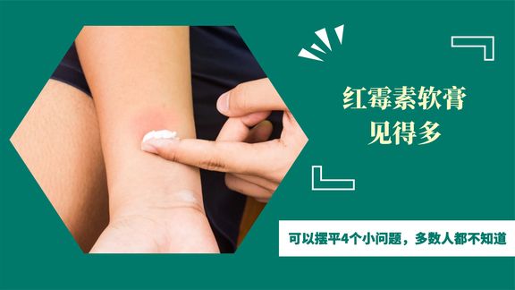 红霉素软膏除了药用,还可以摆平4个小问题,多数人都不知道
