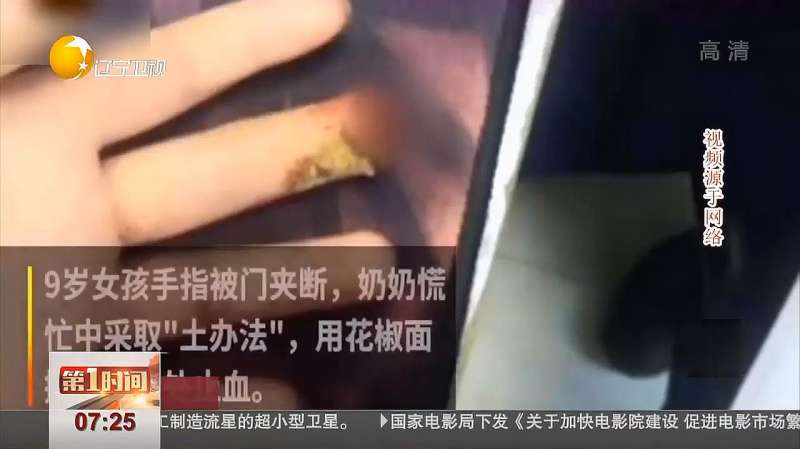 孙女手指被门夹破,奶奶用花椒面止血导致截肢,网友:偏方真可怕
