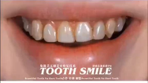 DSD微笑设计你想要的高级感,我们满足你在这拼颜值的时代