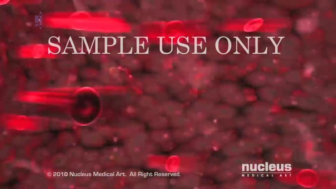 癌症肿瘤细胞结构(3D效果下模拟)