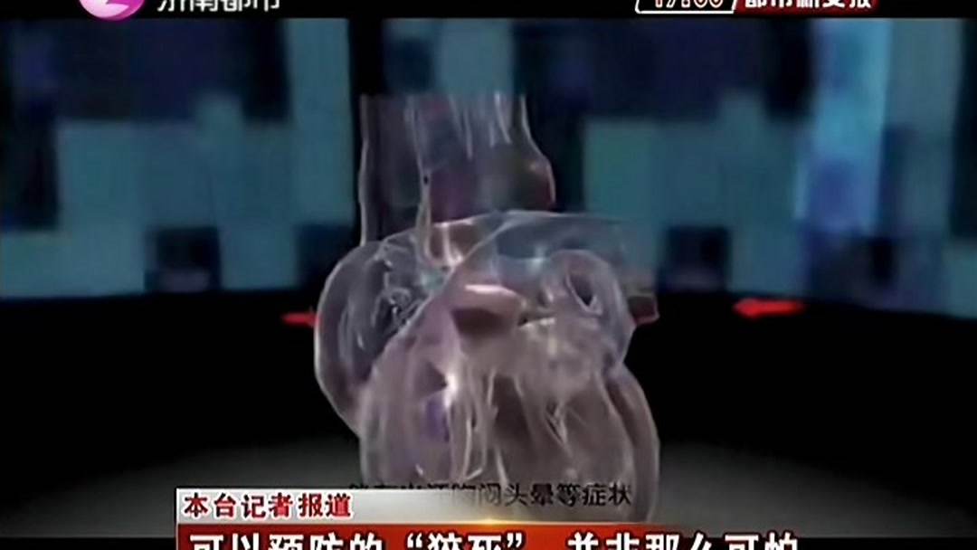 可以预防的“猝死” 并非那么可怕