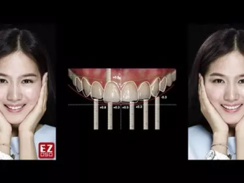 DSD微笑美学设计大师4.5演示