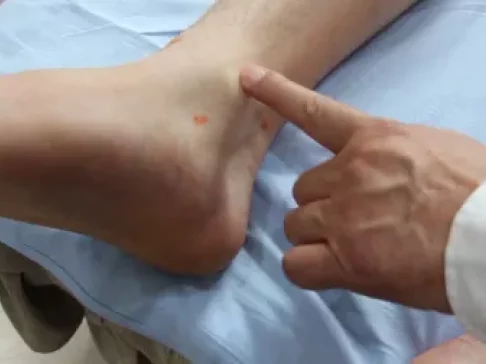 商丘穴