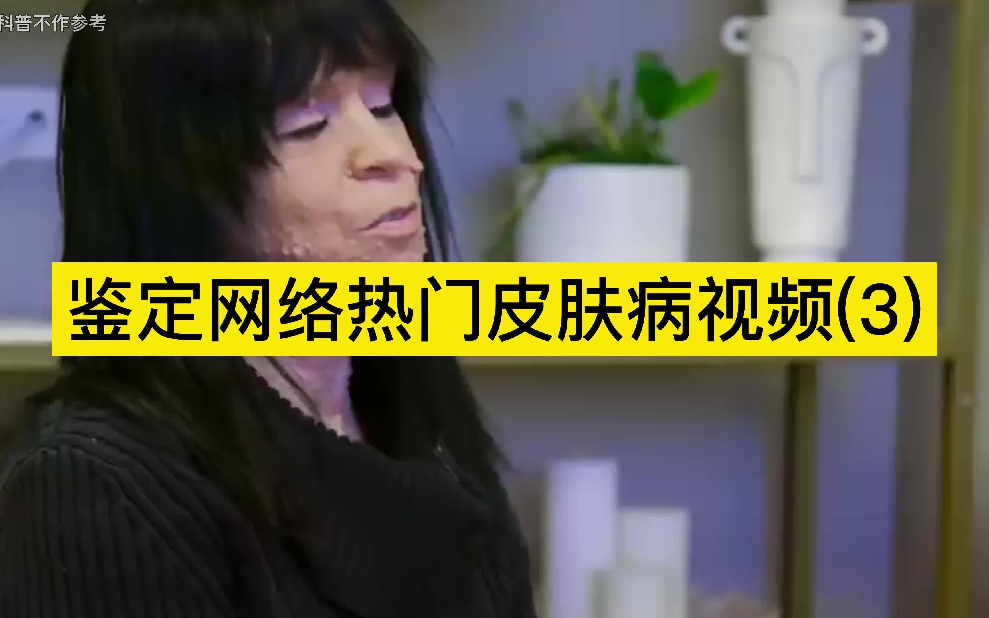 ⚡密恐勿入⚡鉴定网络热门皮肤病视频(3)